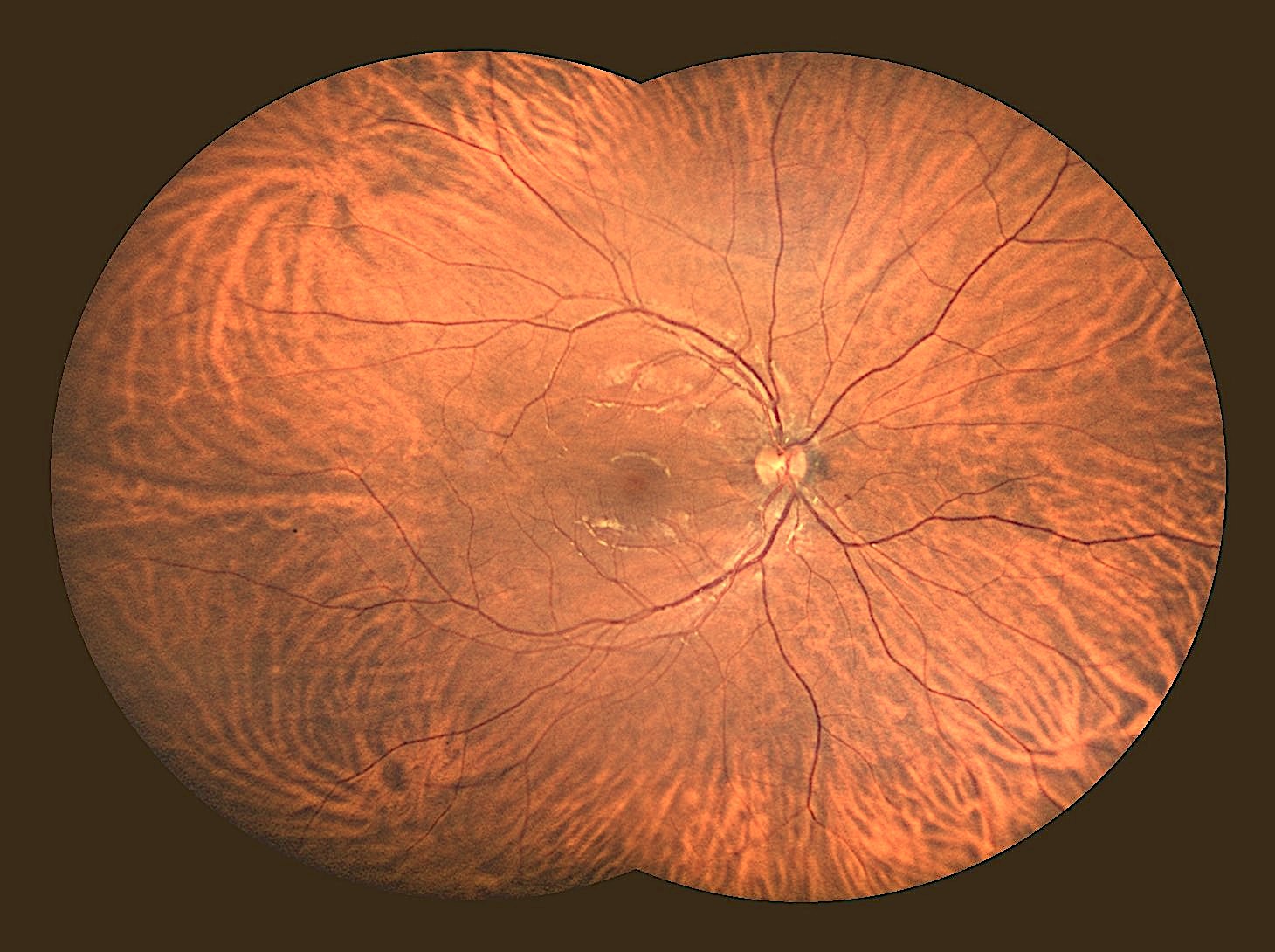 Retinal Imaging – Optometrist / Eye Doctor in Toronto | Clairhurst Eye Care